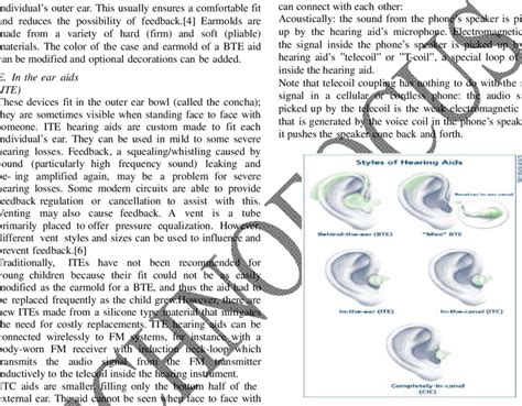 Types Of Hearing Aids Download Scientific Diagram