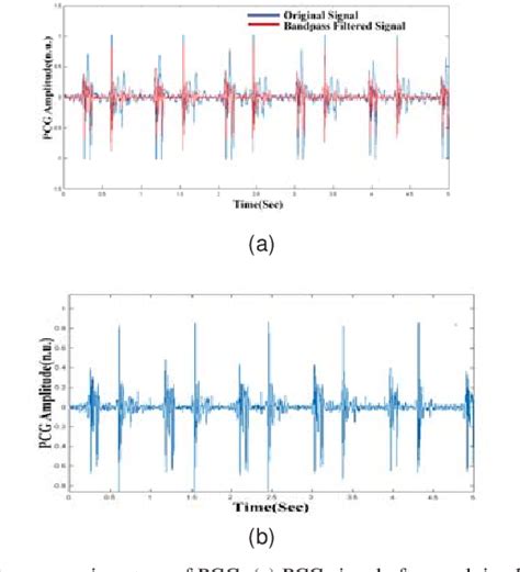 Figure 1 From Classification Of Short Unsegmented Heart Sound Based On
