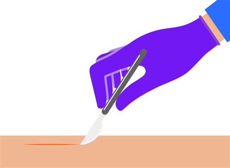 Oncological Surgery Semih Ayanoglu Md Treatments And Practices