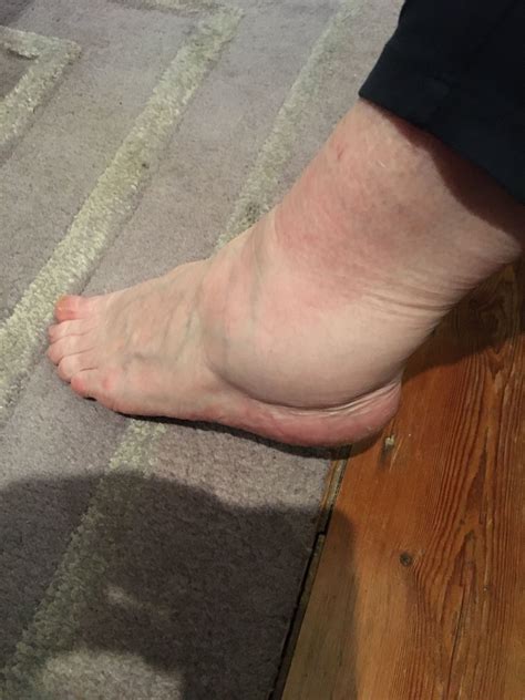 The Reflexology Room Reflexology Lymphatic Drainage