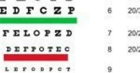 Assessment Of Visual Function Visual Acuity • Nextsense