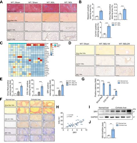 Sex Determining Region Y Gene Promotes Liver Fibrosis And Accounts For