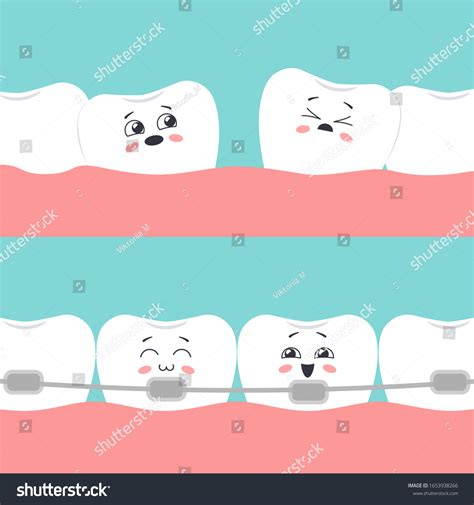 Concept Orthodontic Treatment Distorted Teeth Before Stock Vector