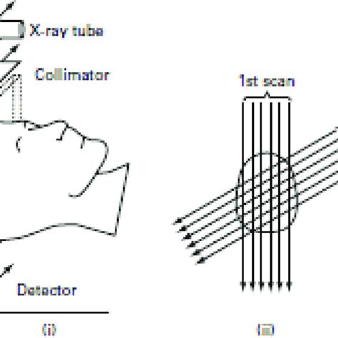 pdf research in medical imaging using image processing techniques