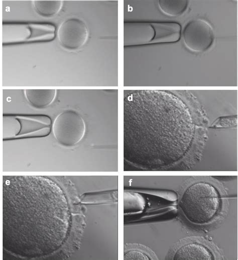 猴体细胞核移植 —bio 101