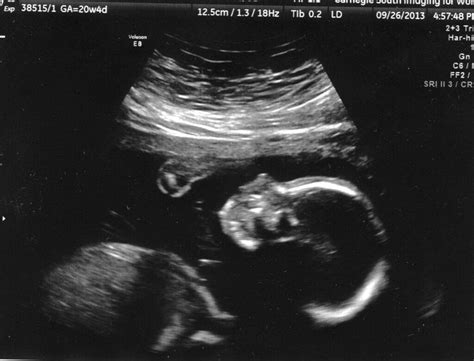 Conquering The Nyt Crosswords Tedious Task A Complete Guide To Clues And Solutions