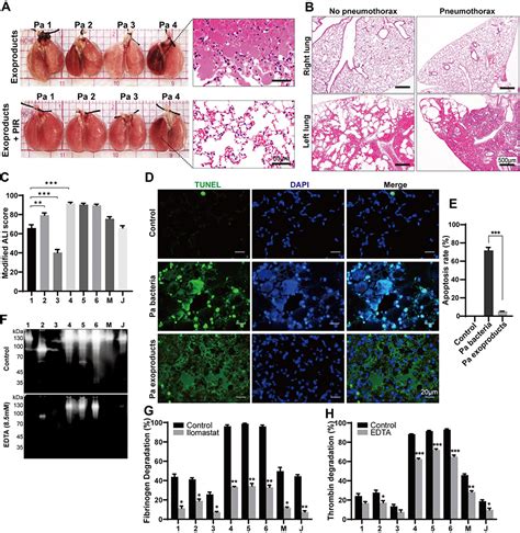 Pseudomonas Aeruginosa Secrete Lasb Elastase In Mice Jir
