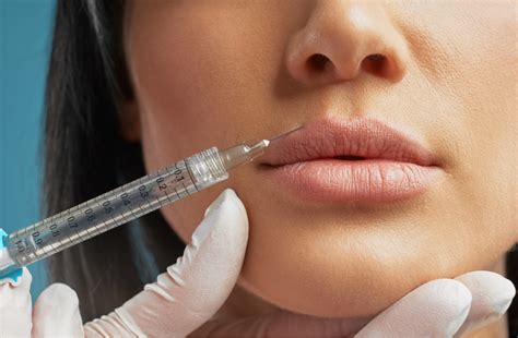 How Many Units Of Botox For A Lip Flip Eau Claire Body Care