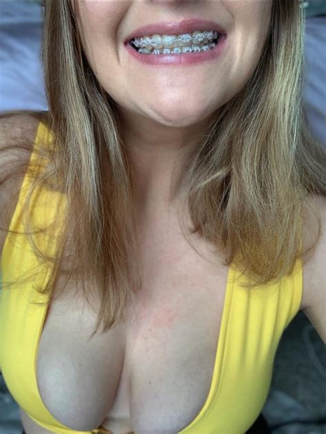 I Think My Braces Would Look Better Covered In Cum What Do You Think
