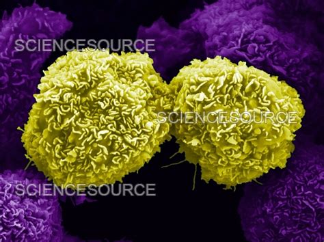 Pancreatic Cancer Cells Sem Stock Image Science Source Images