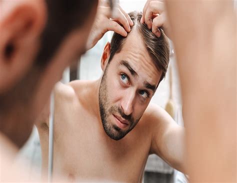 Tudo o que você precisa saber sobre transplante capilar