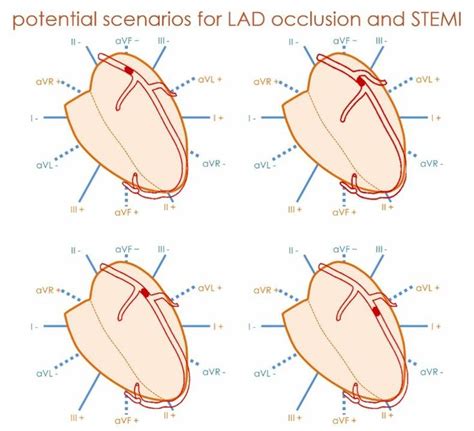 Pin By Andres Sanchez On Cardiology Ekg Illustrations And Posters