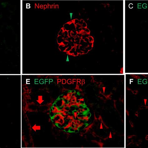 Protein Expression Of EGFP And Glomerular Cell Markers In Nephrin EGFP