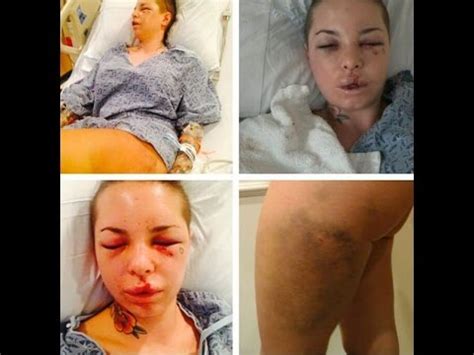 Christy Mack Beating Telegraph