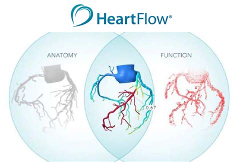 University Radiology Nj Imaging Center And Diagnostic Radiology