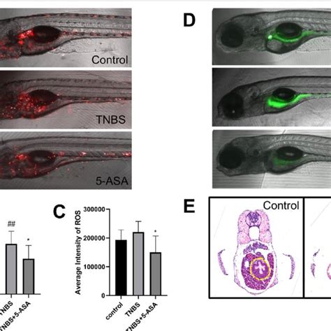 Tnbs Induced Ibd Phenotypes In Zebrafish A B The Intestinal