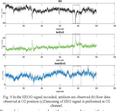 figure 1 from removal of ocular artifacts from eeg using adjust based