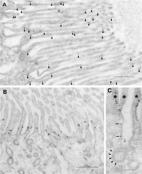 Immunoelectron Microscopic Immuno Em Analysis Of The Nhe3
