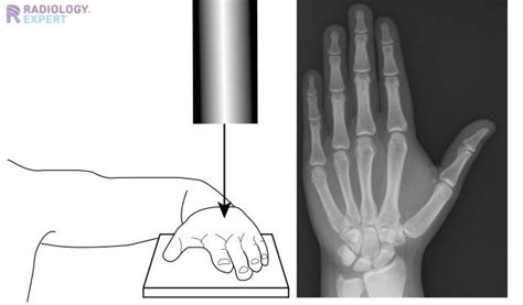 Xray Hand New Page 1
