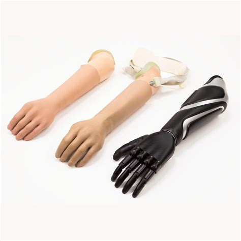 Upper Limb Prosthesis Jasad