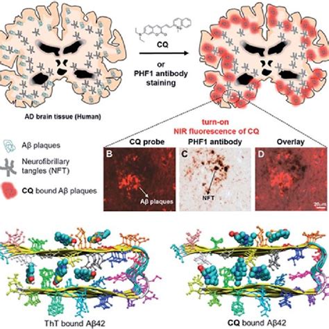 Schematic Representation Of The Glucose Biosensor Invented By Clark And Download Scientific
