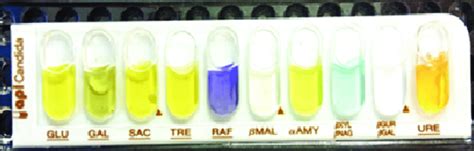 Identification De Candida Tropicalis Sur Api Candida Download Scientific Diagram