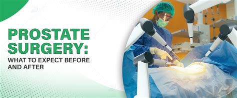 Prostate Surgery What To Expect Before And After