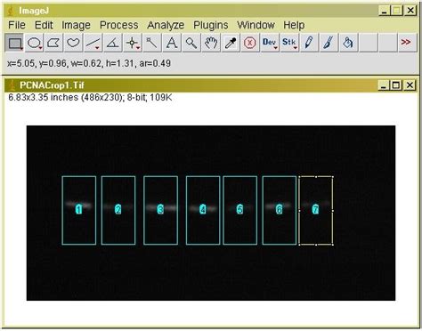 tute1 basic image processing with imagej youtube