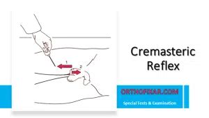 Cremasteric Reflex Explained Easily Orthofixar