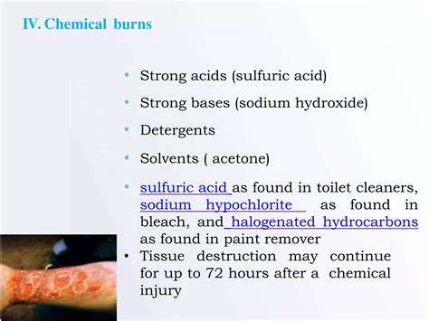 Burns Types And Its Management Pptx
