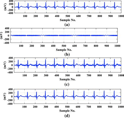 Plots Of Ecg Signal A Clean Signal B Pli Noise C Ecg Signal With Pli