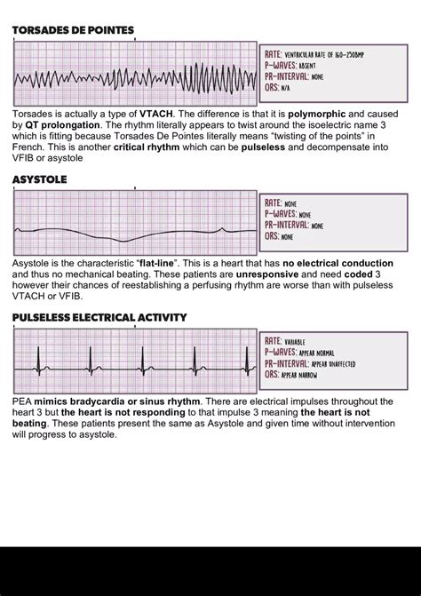 Ecg Interpretation Cheat Sheet Abraham Baldwin Agricultural College