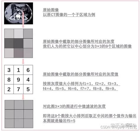 医学影像知识（二）：医学影像常见数据预处理方式医学图像预处理 Csdn博客