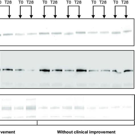 A Cascade Of Human Complement Component C3 Cleavages And The