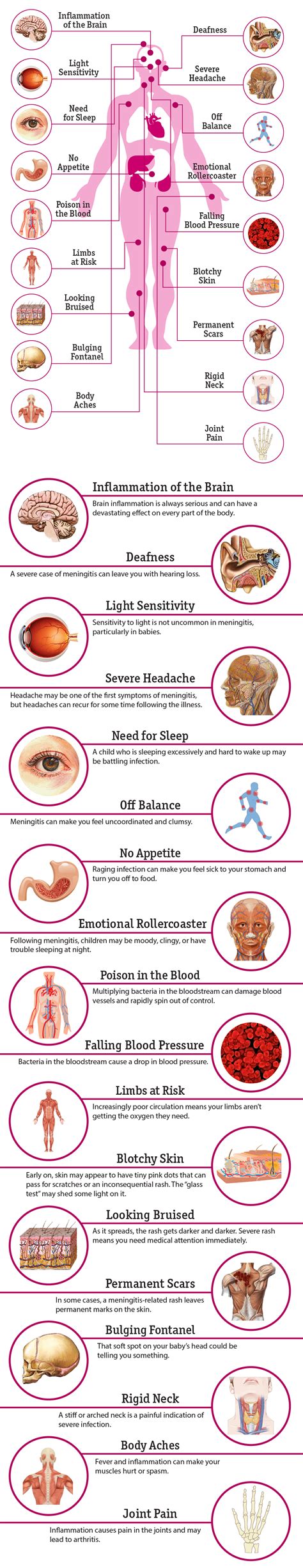 Symptoms Of Bacterial Meningitis In Adults Telegraph