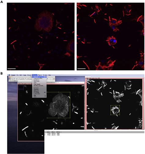 Quantification Of Phalloidin Defined Area Using Imagej A Example Of
