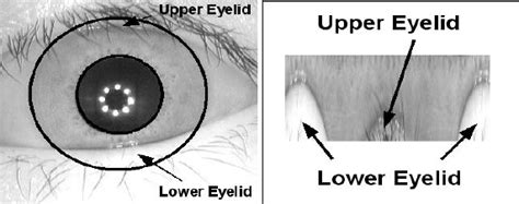 A Iris Localization B Unwrapped Iris Download Scientific Diagram