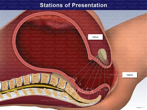 Stations Of Presentation Sagittal View Trial Exhibits Inc