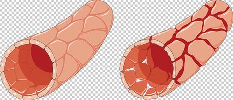 Apoptosis Vector Illustration