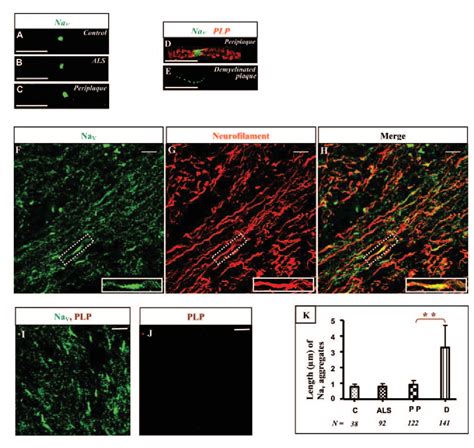 Figure 1 From Nodal Paranodal And Juxtaparanodal Axonal Proteins During Demyelination And