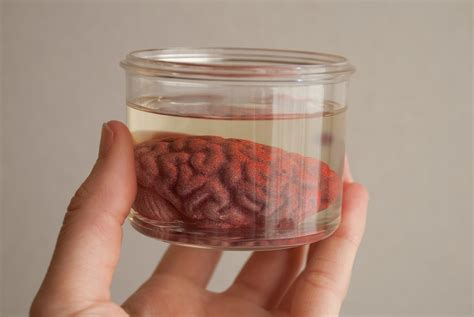 Abnormal Brain Young Frankenstein Etsy