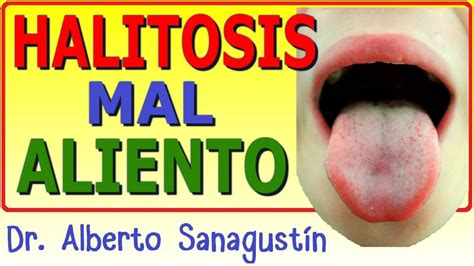 HALITOSIS mal aliento causas diagnóstico y tratamiento YouTube