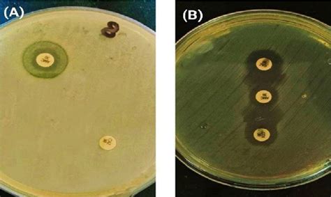 A Combination Disc Test Cdt For Esbl Production Confirmed By An