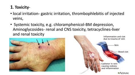 Principles Of Antibiotic Chemotherapy Pptx