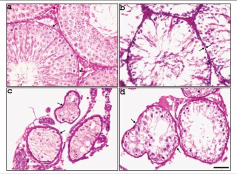 Figure 5 From Heat Stress Decreases Testicular Germ Cell Proliferation