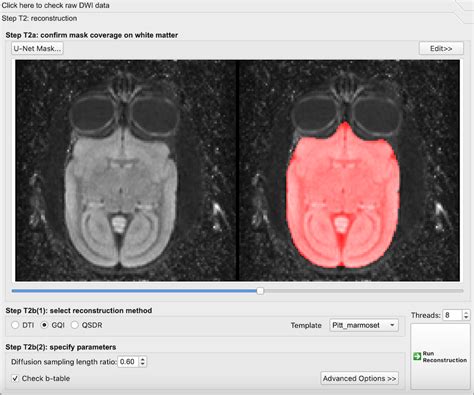Dwi Marmoset Brain Connectivity Brainminds