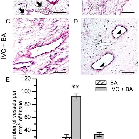 A Cmfda Labeled Cells Green In The Ventricle Wall Of A Scaffold