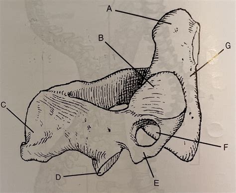 Lateral Aspect Of Axis C2 Diagram Quizlet