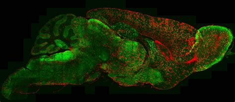 Microscope Image Showing Astro [image] Eurekalert Science News Releases
