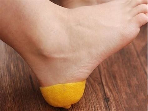 Как победить трещины на пятках Dry Cracked Feet Cracked Feet Dry Heels